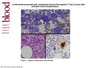 Parvovirus B19–induced pure red cell aplasia in a heart transplant ...