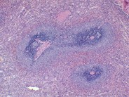 Normal Lymphoid Tissues: Part 4 - 8.