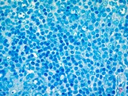 Normal Lymphoid Tissues: Part 4 - 2.