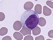 Large granular lymphocytes