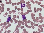 Cytogram - normal peripheral blood