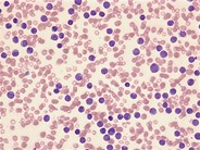 platelet clumps significantly with time gone