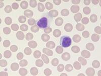 Large granular lymphocyte 1