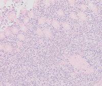 CD3 immunostain