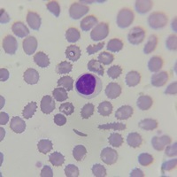 Lymphocyte morphology